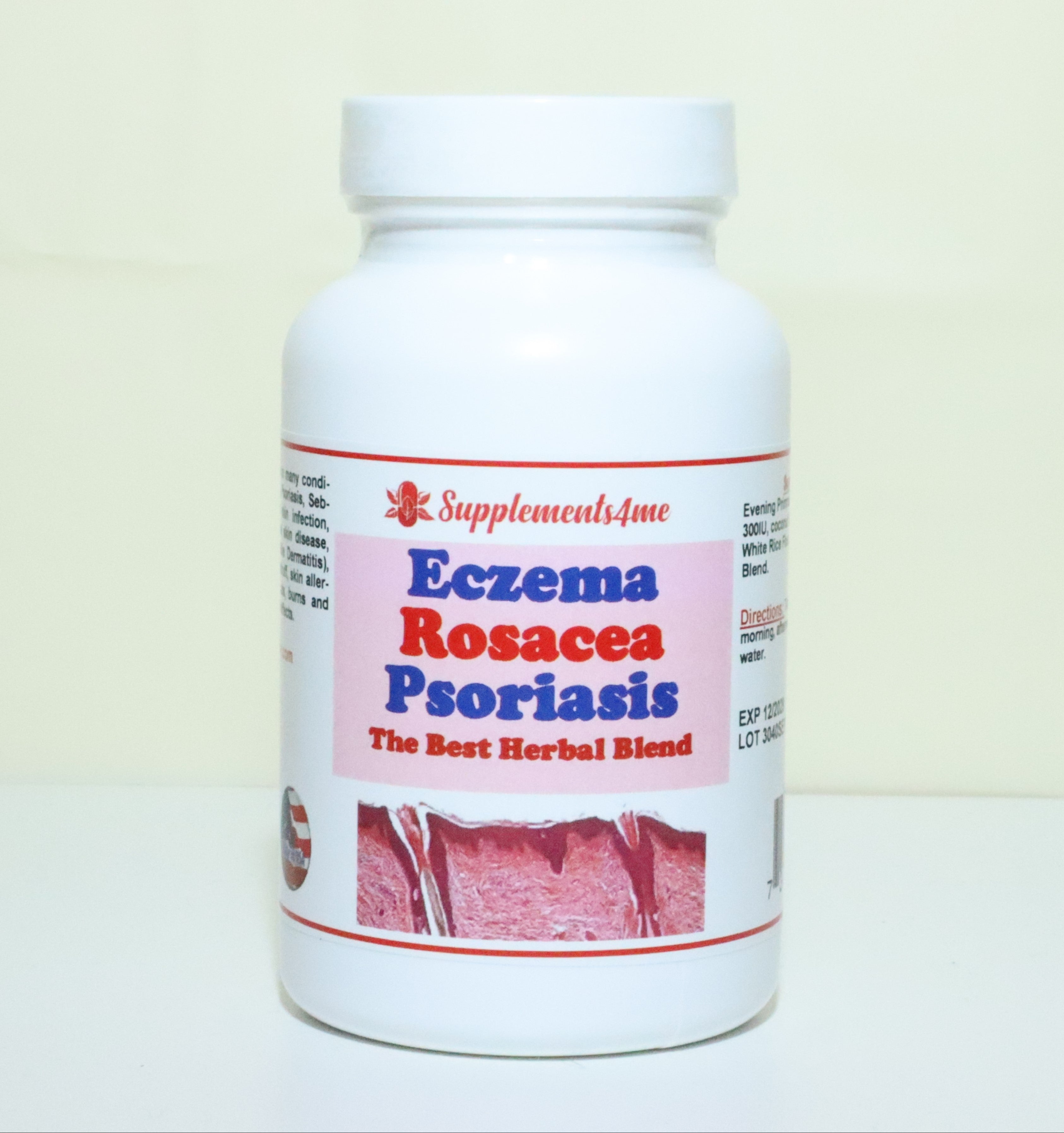 GET RID OF ECZEMA, ROSACEA & PSORIASIS NATURALLY - Prevent and Treat ...